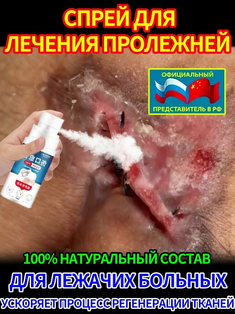 Спрей от пролежней 30 мл для ран и ожогов, Крем против пролежней и от опрелостей ранозаживляющий для лежачих больных, Средствами по уходу за больными