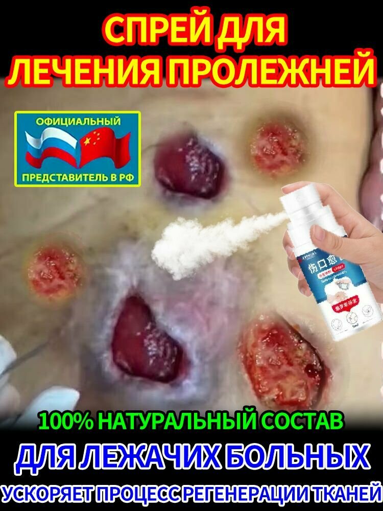 Спрей от пролежней 30 мл для ран и ожогов, Крем против пролежней и от опрелостей ранозаживляющий для лежачих больных, Средствами по уходу за больными