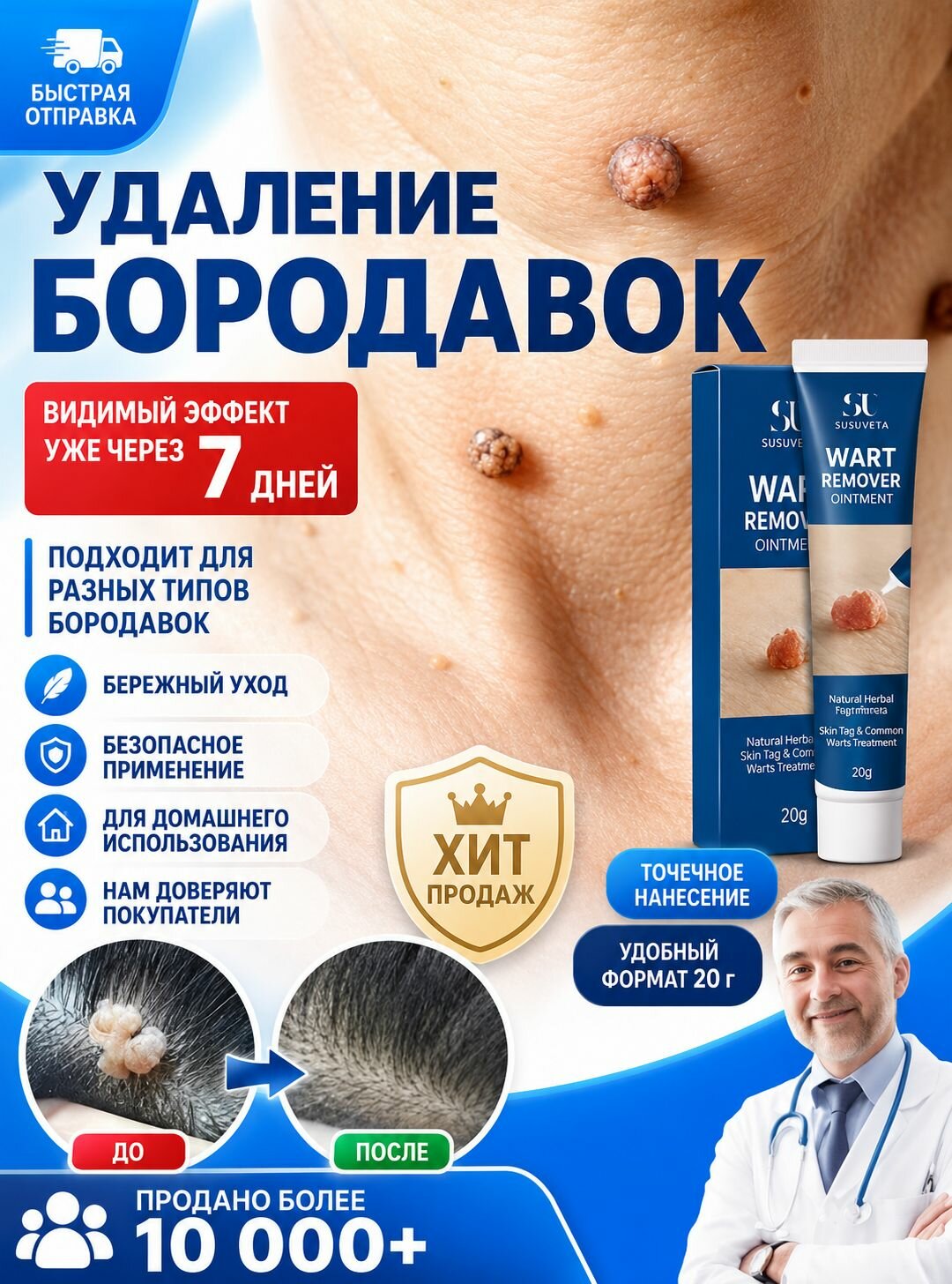 SUSUVETA крем от бородавок и папиллом, средство для удаления сухих мозолей и натоптышей, уход за кожей рук и ног, 20 г