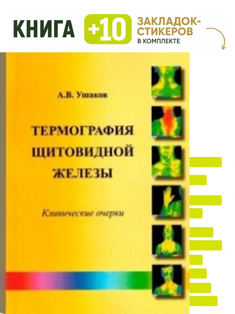 Термография щитовидной железы. Клинические очерки. Комплект: книга + 10 закладок-стикеров