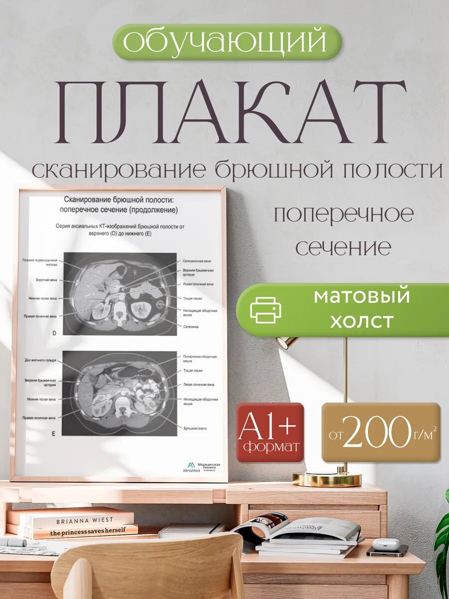 Сканирование брюшной полости: поперечное сечение (продолжение), плакат, матовый холст от 200 г/кв. м, размер A1+