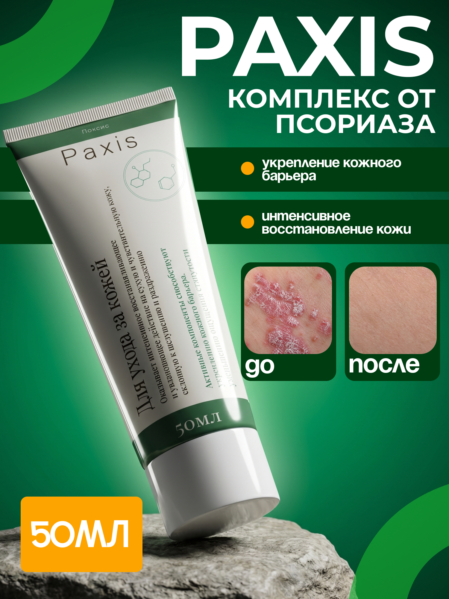 Paxis (Паксис) — крем для ухода при псориазе, восстановление и увлажнение, туба 50 мл