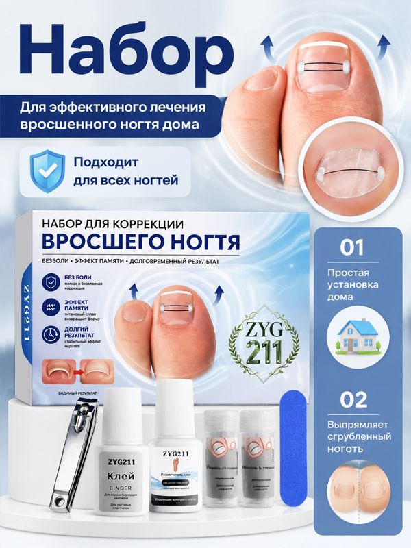 Bросших ногтей Комплект из 30 никелид-титановых корректоров для вросших ногтей скобы для ногтей фиксаторы ногтей набор корректоров