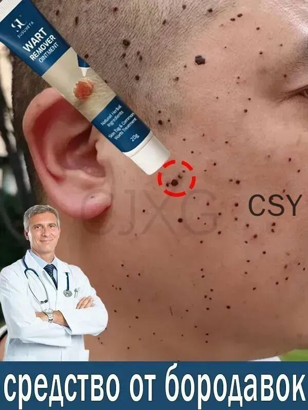 7 дней без следов удаление Мазь от бородавок, для рук, для шеи, чистотел от бородавки, от сухих мозолей 20 мл