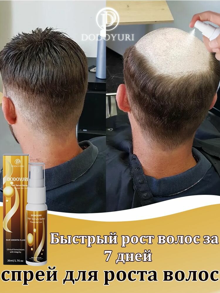 Спрей для роста волосспособствует росту, увеличению густоты, предотвращает выпадение, стимулирует регенерацию, увеличивает плотность на 90%, натуральные растительные экстракты, 30 мл.