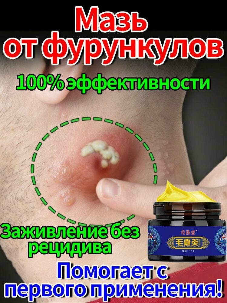 Китайская мазь от устранения фурункулов и гнойников
