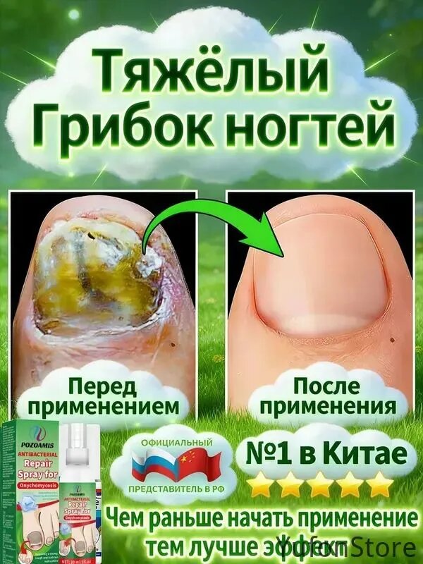 Спрей от онихомикоза масло от грибка ногтей на ногах. Средство от грибка ногтей на ногах