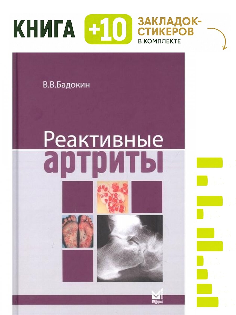 Реактивные артриты. Комплект: книга + 10 закладок-стикеров