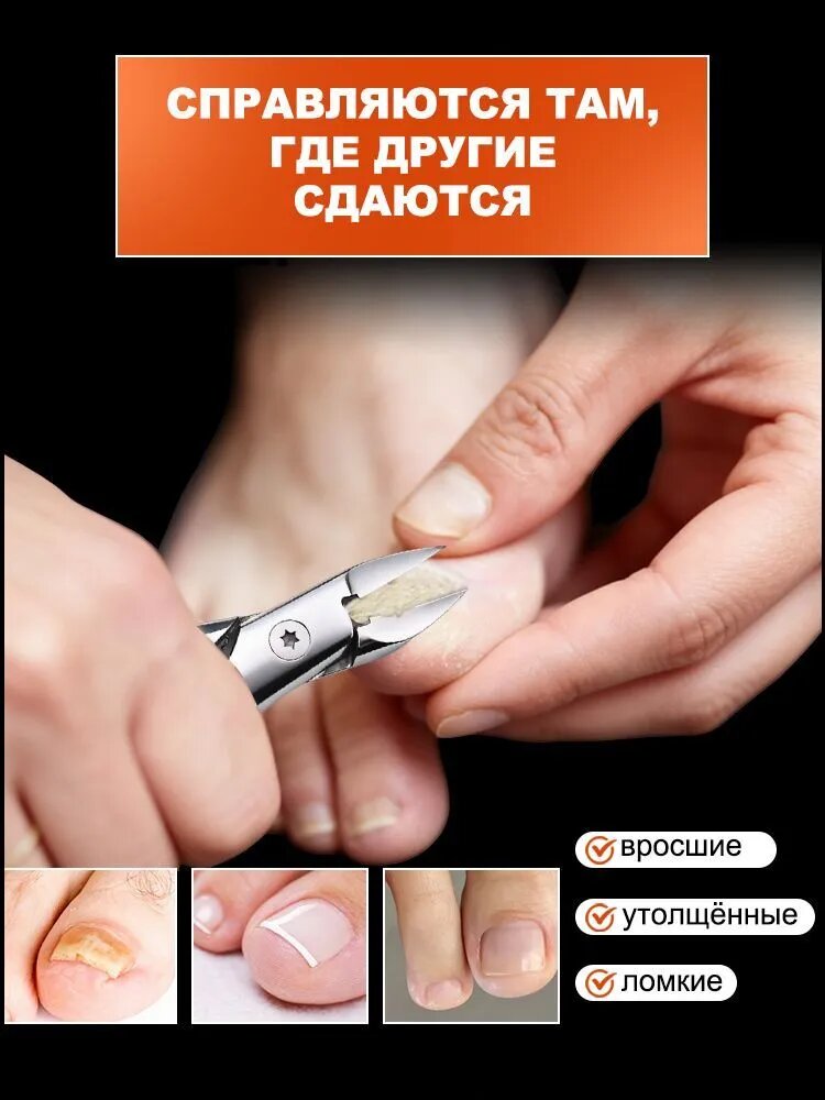 Кусачки для ногтей — фото 1