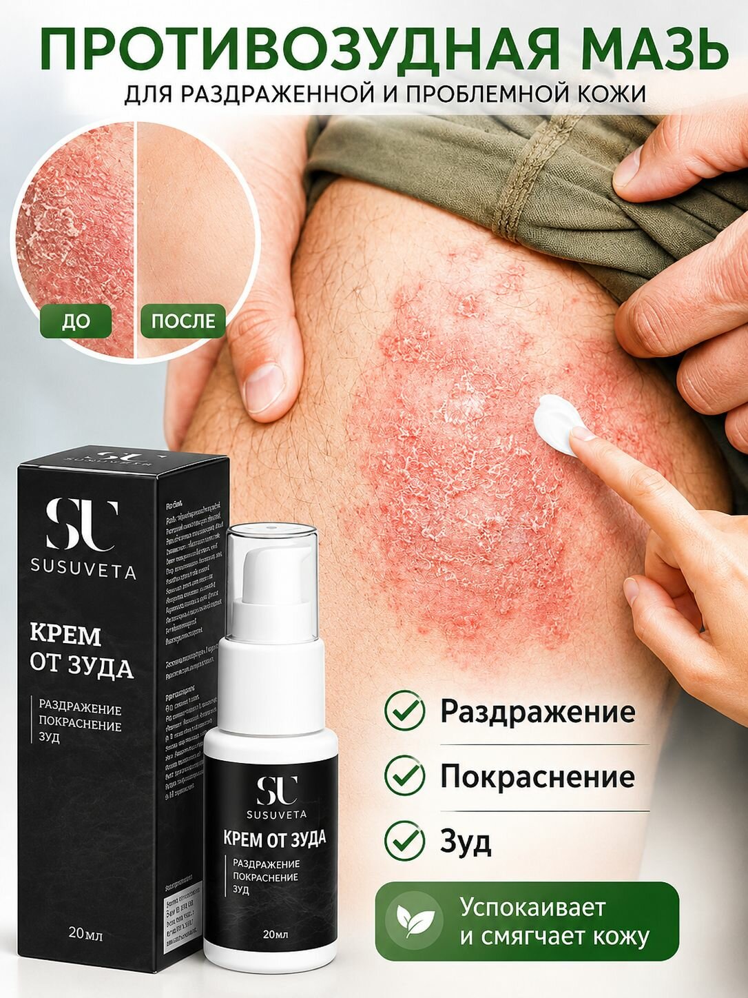 Крем от зуда и раздражения 20 г, успокаивающий крем для кожи при укусах насекомых, покраснении, аллергическом дискомфорте и сухости