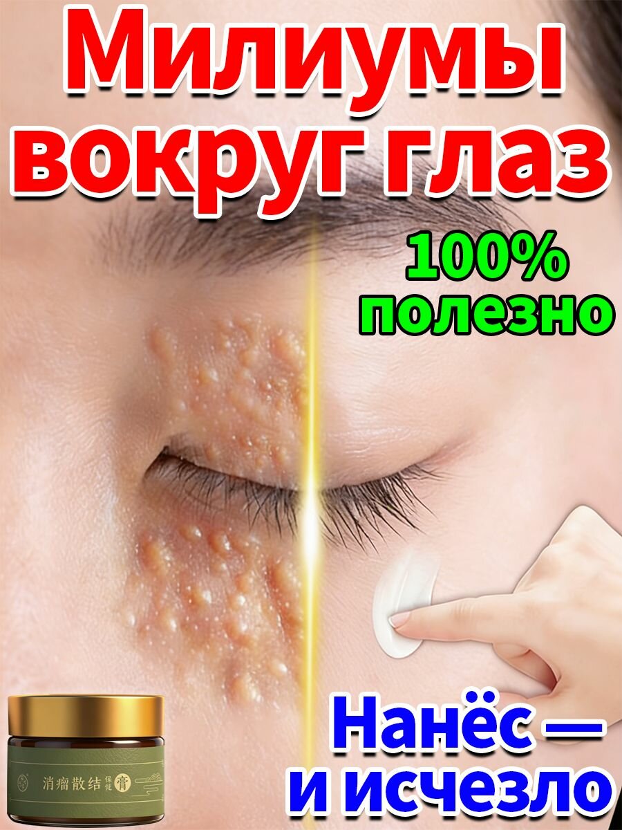 Мазь от милиумов от просянки белых угрей и роговых кист