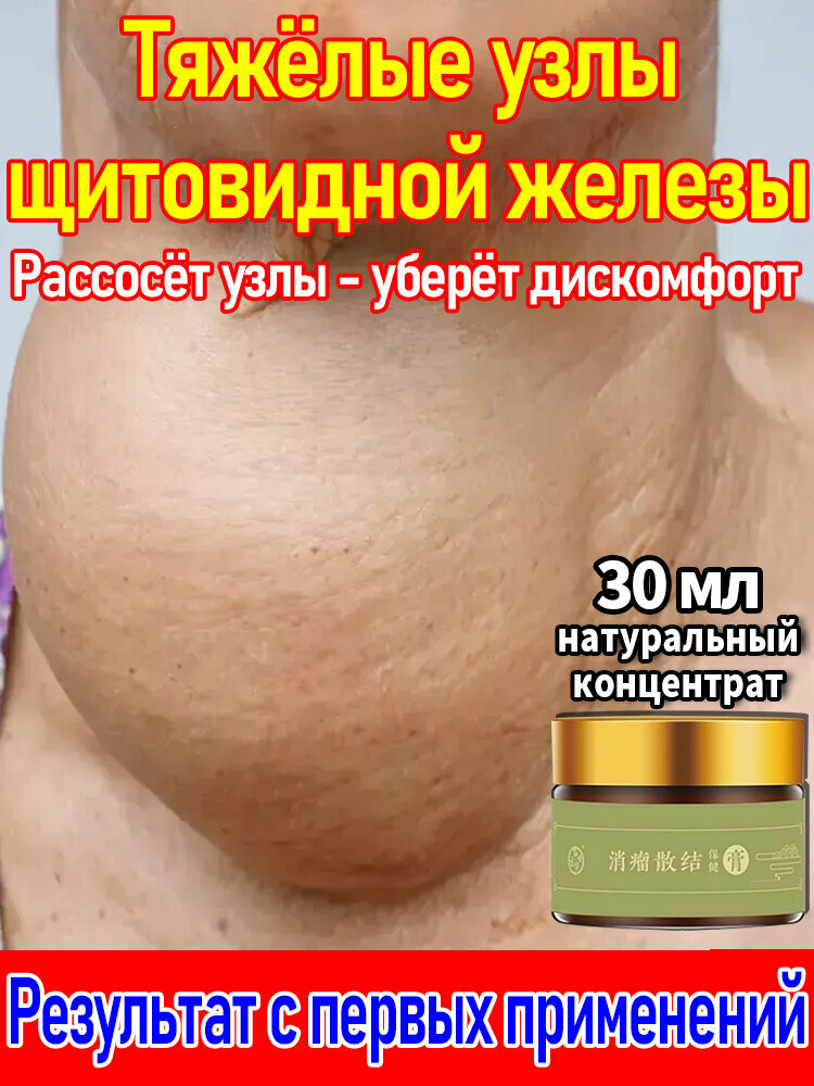 Натуральная мазь для щитовидной железы от узлов