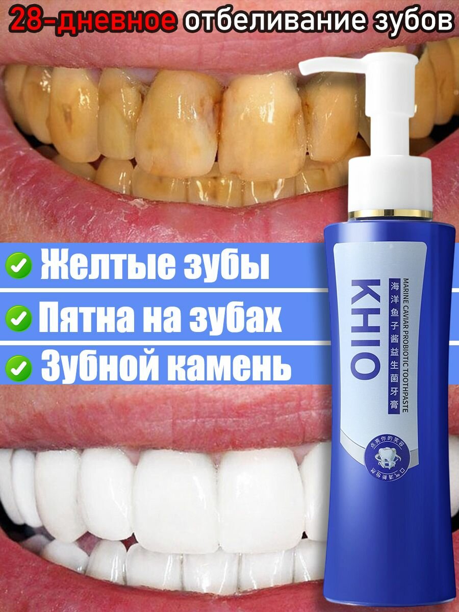 Пробиотическая отбеливающая зубная паста, эффективно удаляет желтизну, пятна, зубной камень, освежает дыхание и восстанавливает зубную эмаль, 150 г