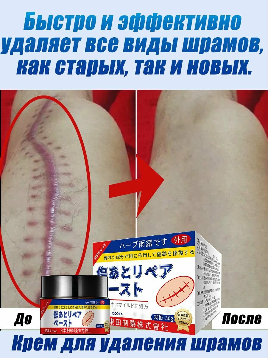 Крем для удаления шрамов/Удаление рубцов, натуральные ингредиенты, Для лица и тела/30 г