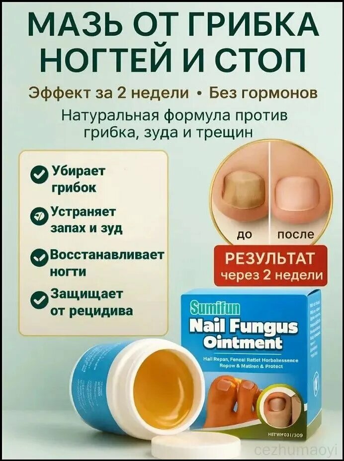 Мазь от грибка ногтей / Крем для эффективной борьбы с несовершенствами / Чудо средство для ухода за ногами против онихолизиса