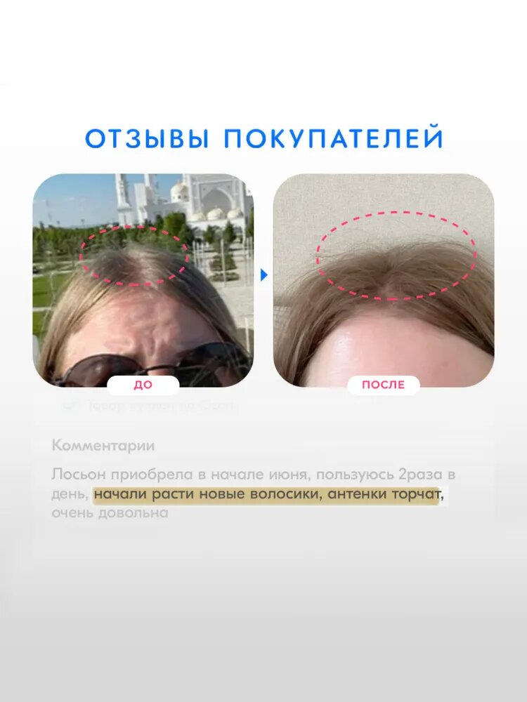 Лосьон для волос, 42 мл — фото 1