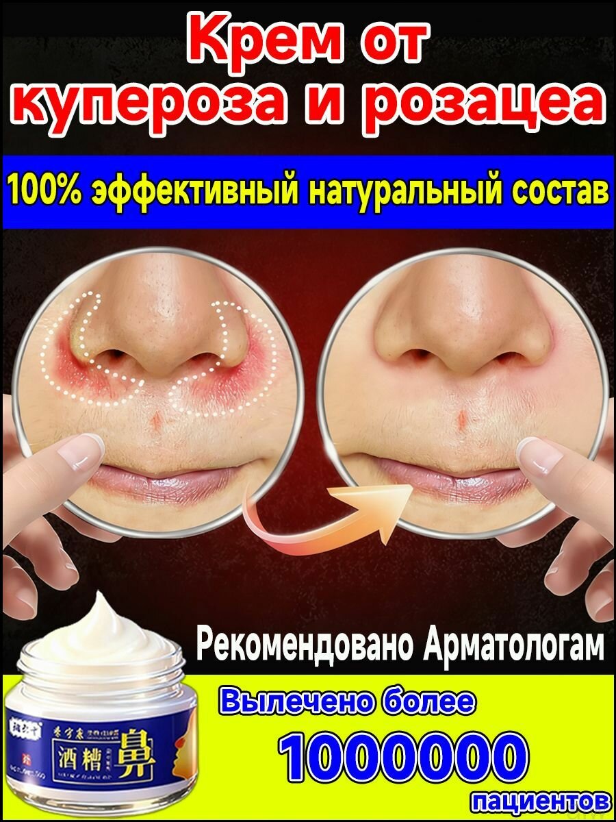 Гельтек Гель Демотен от прыщей акне демодекоза розацеа для проблемной и жирной кожи лица 30r