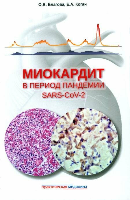 Миокардит в период пандемии SARS-CoV-2. Благова О. В, Коган Е. А.