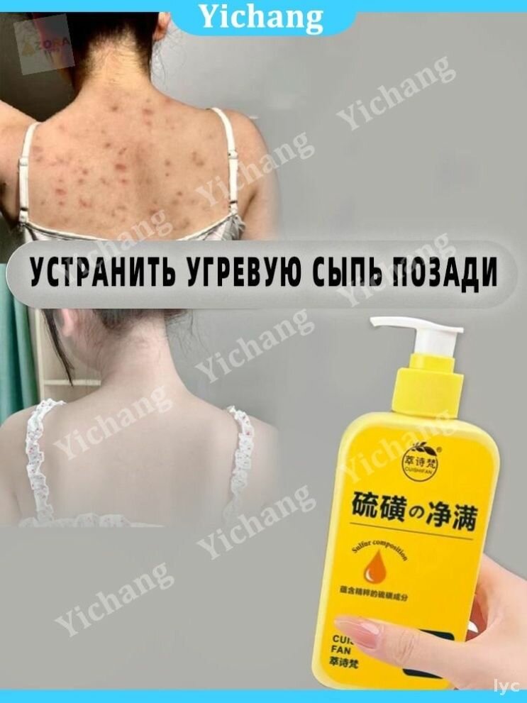 Эксклюзивный гель для душа 300 мл против прыщей и клещей, обеспечивающий глубокую стерилизацию для всех типов кожи