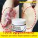 Крем для ухода за кожей SCAR HEALTH CREAMCREAM от шрамов и рубцов 100% эффективн...