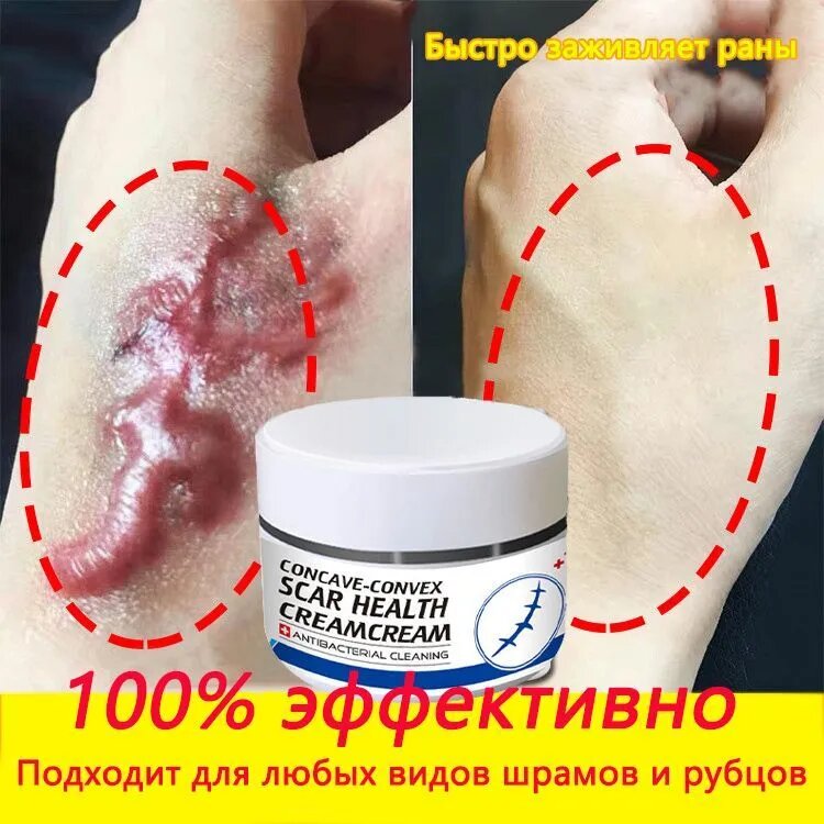 Крем для ухода за кожей SCAR HEALTH CREAMCREAM от шрамов и рубцов 100% эффективно