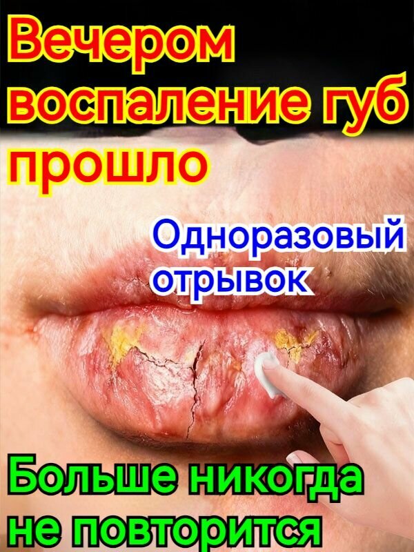 Крем от герпеса и хейлита Sumifun, против трещин и сухости на губах