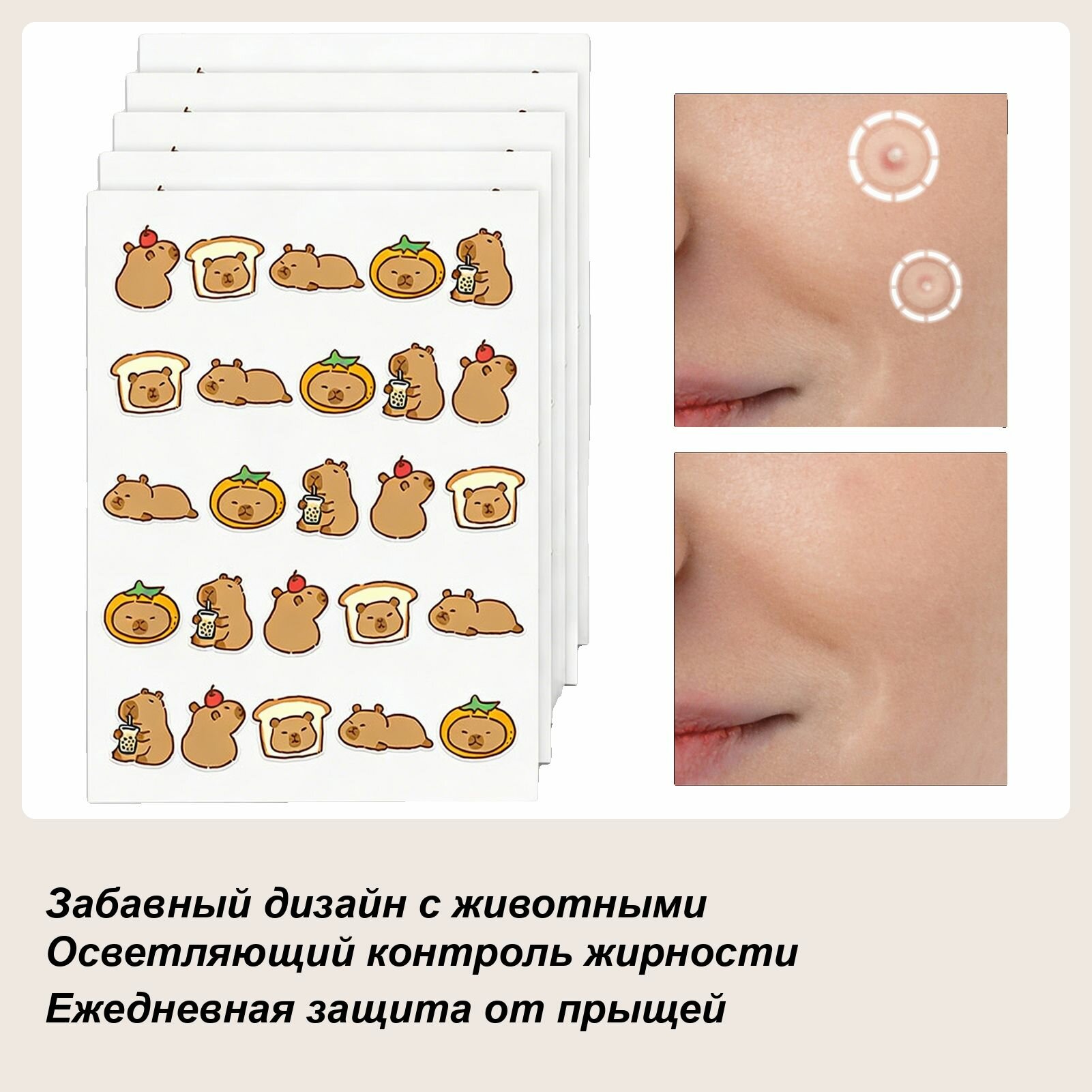 Патчи от прыщей для лица, наклейка