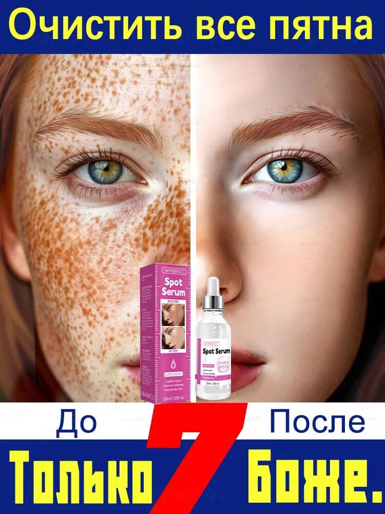 Масло против веснушек 30 г, подходит для лица, борется с пигментацией и пигментными пятнами, вызванными веснушками, подходит для кожи лица и тела днем и ночью.
