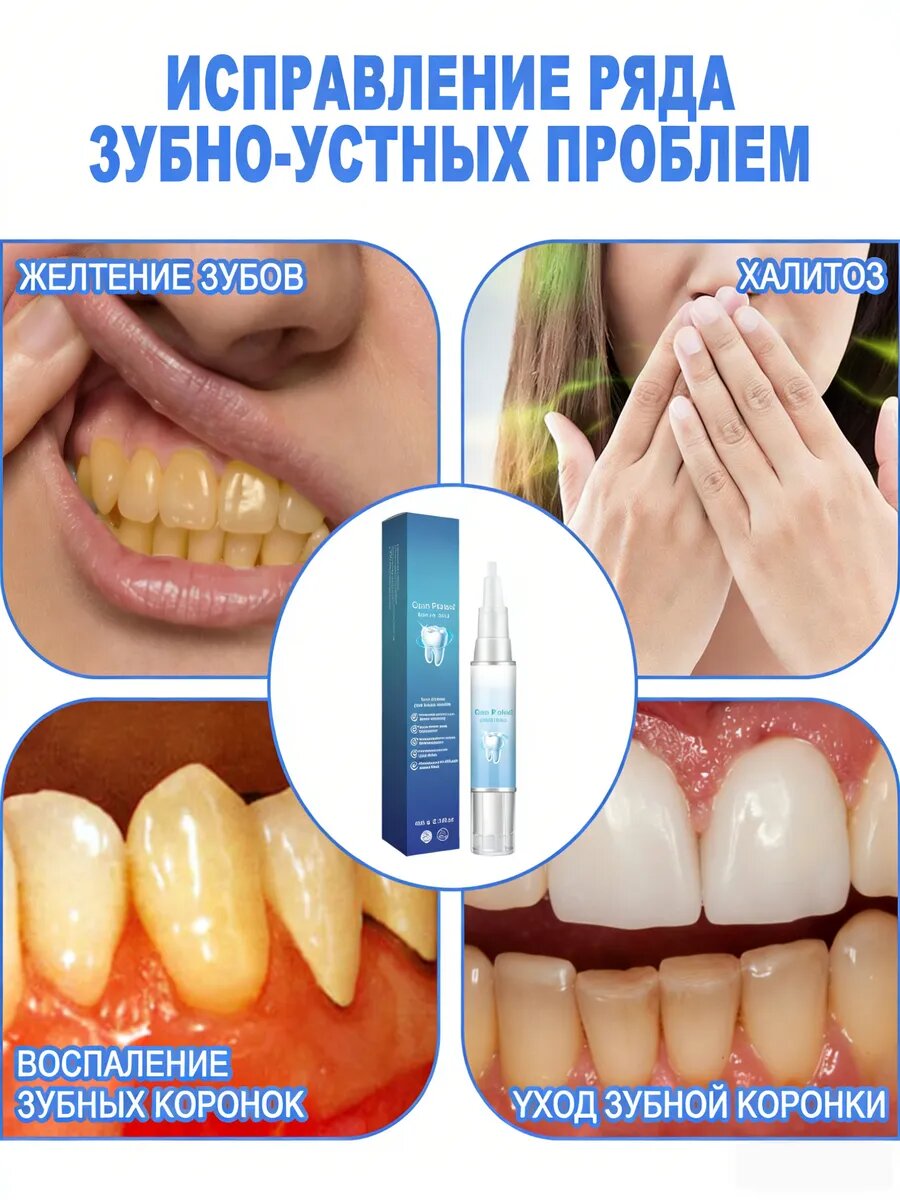 Карандаш для отбеливания Зубов, Аккуратно очистите зубы, чтобы избавиться от желтых пятен на зубах и зубного камня