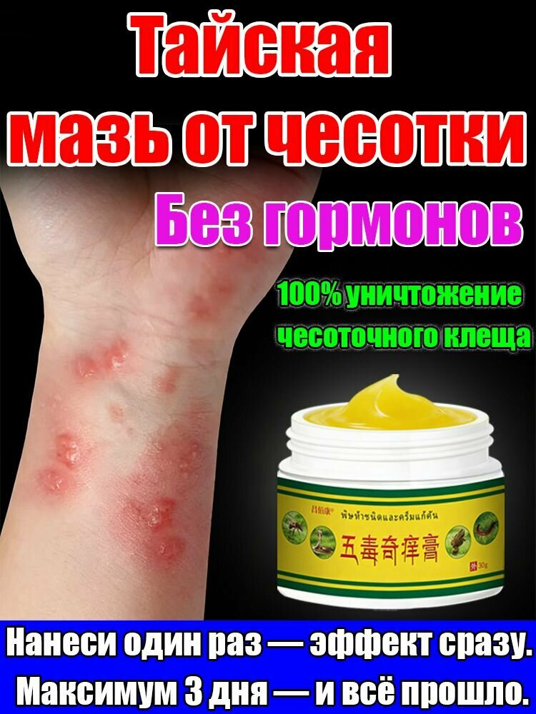 Мазь от укусов постельных клопов и комаров