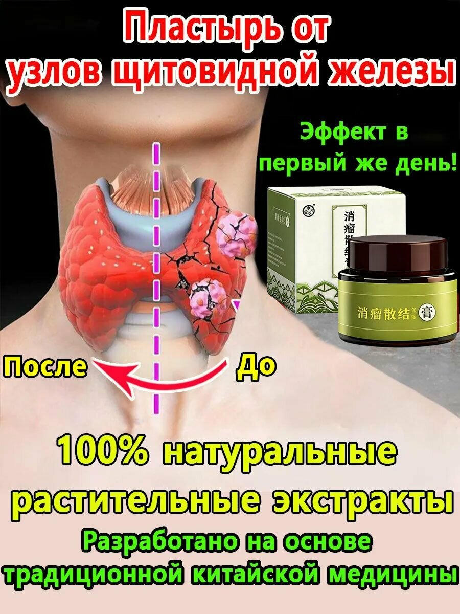 Средство от узлов щитовидной железы, Узловой зоб, Китайская чудодейственная мазь 50г