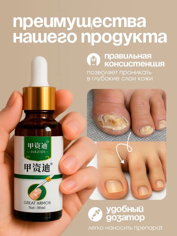 Масло для ногтей от грибка, средство для лечения грибка, 30 мл, лечение онихолизиса, 1 шт, уход за кожей, для п