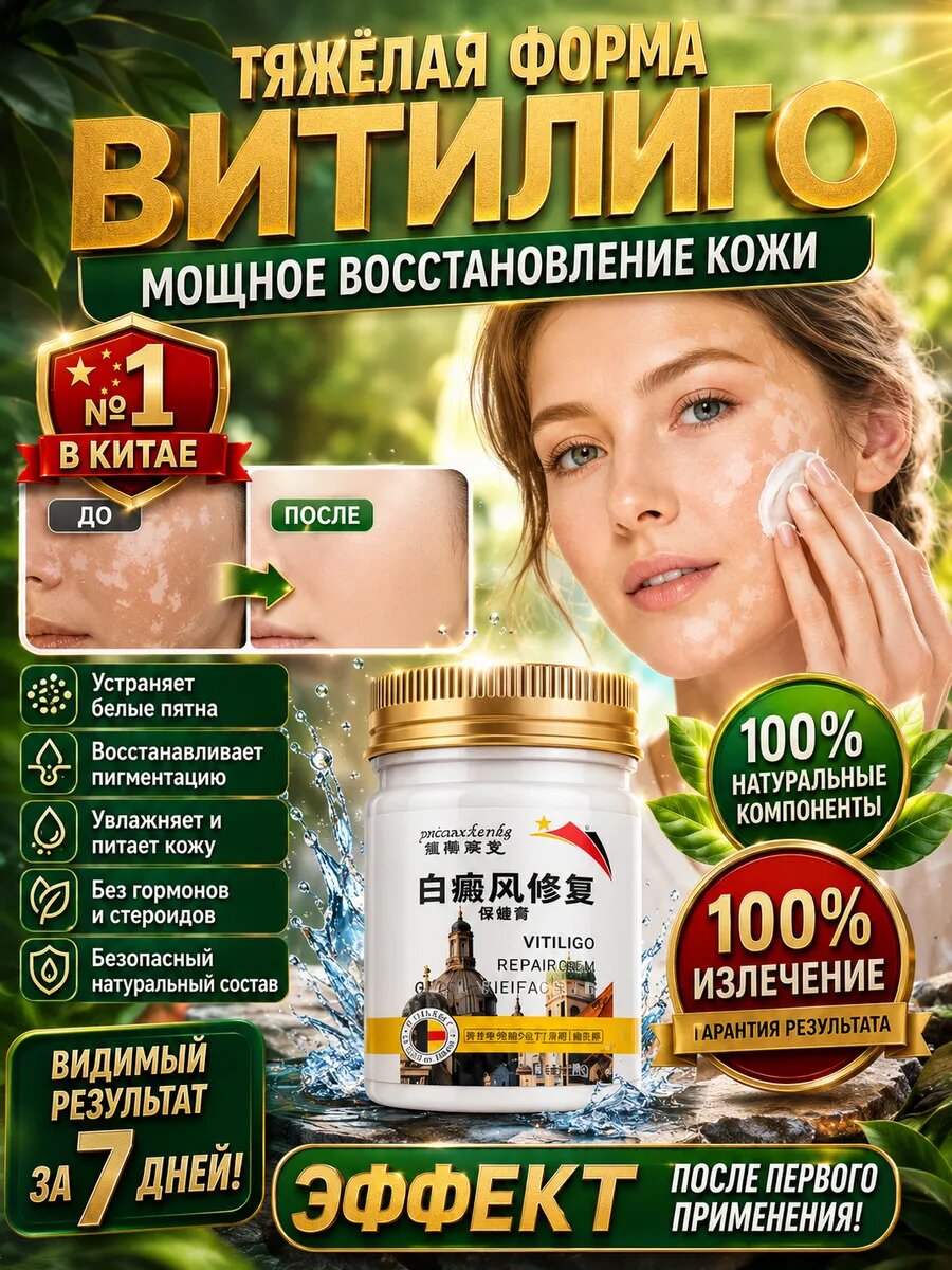 Anti vitiligo Мазь от витилиго китай 50г