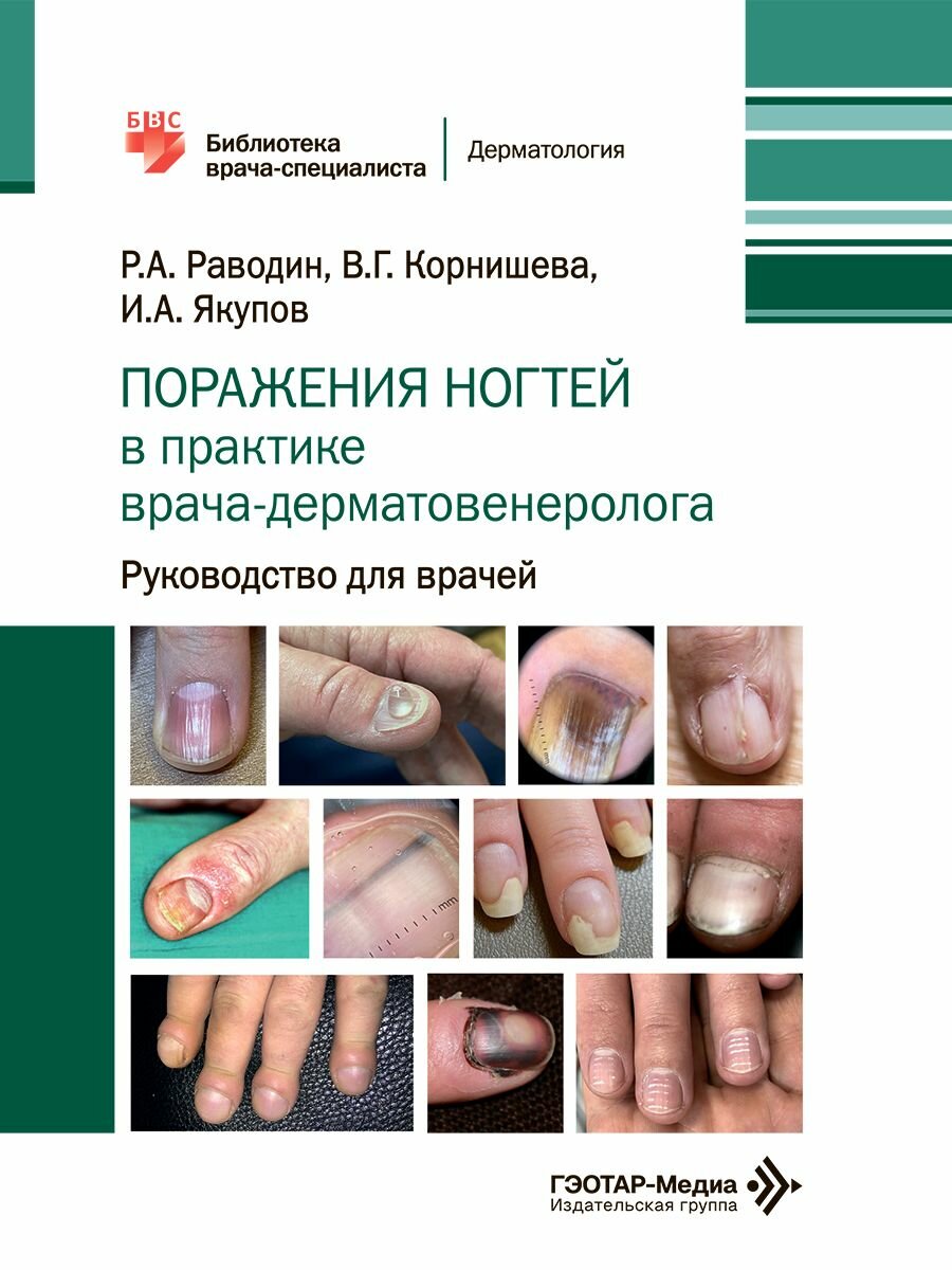 Поражения ногтей в практике врача-дерматовенеролога. Руководство для врачей