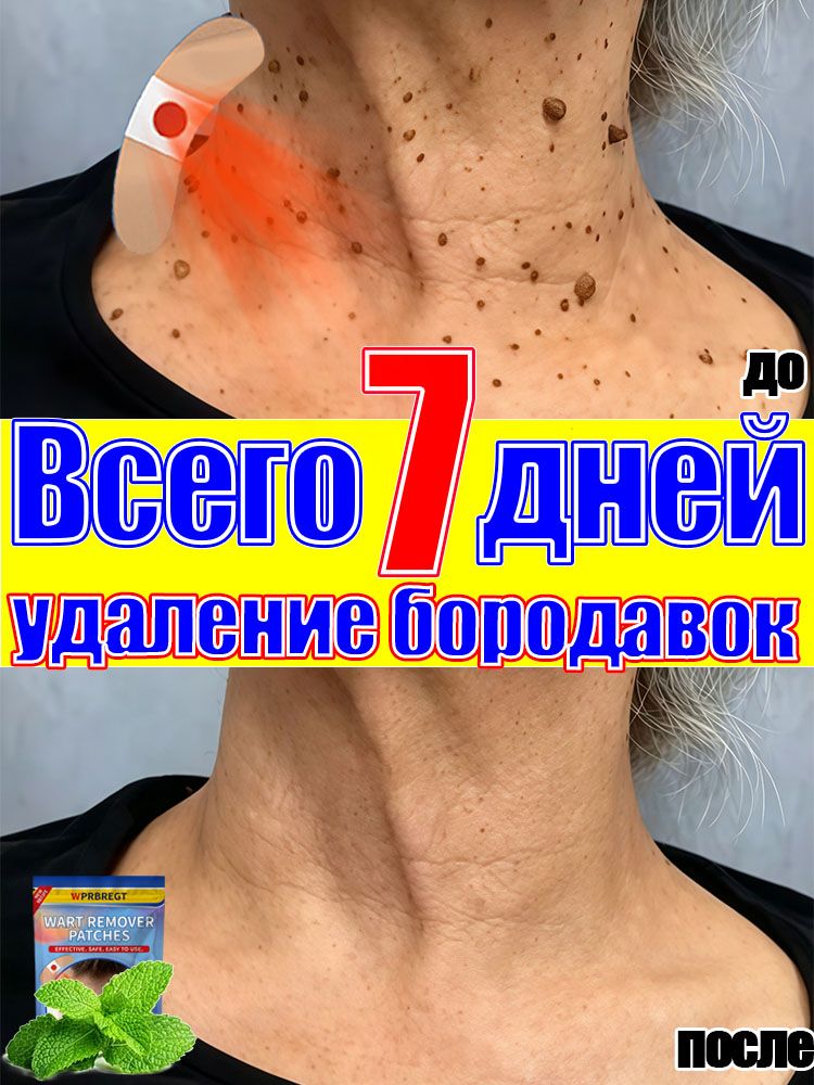 7 дней без следов удаление Пластырь от бородавок Пластырь средство для удаления бородавок, папиллом и родинок, безболезненно, не оставляет следов 20 шт