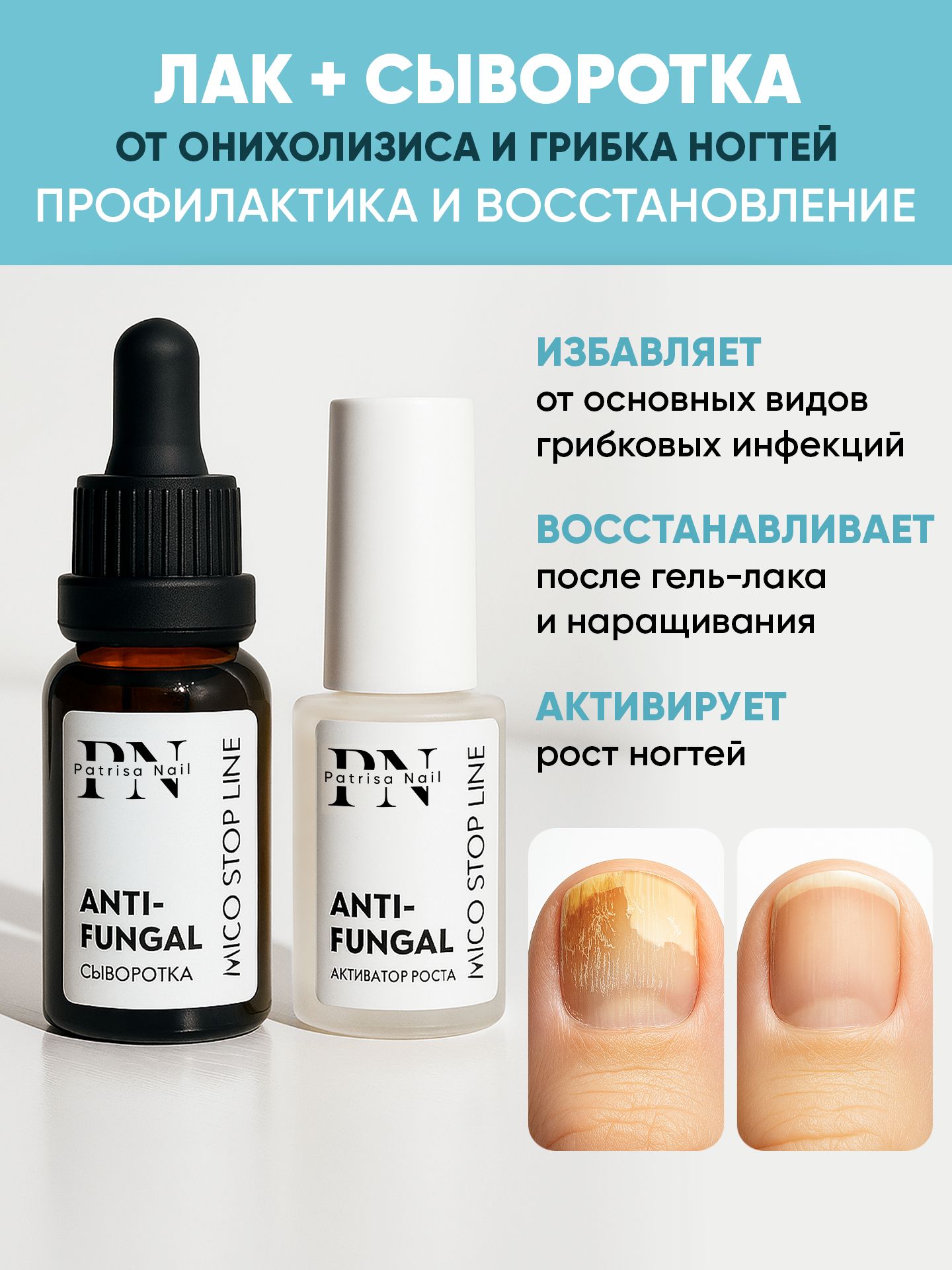 Набор Активатор Антифунгал +Сыворотка Антифунгал
