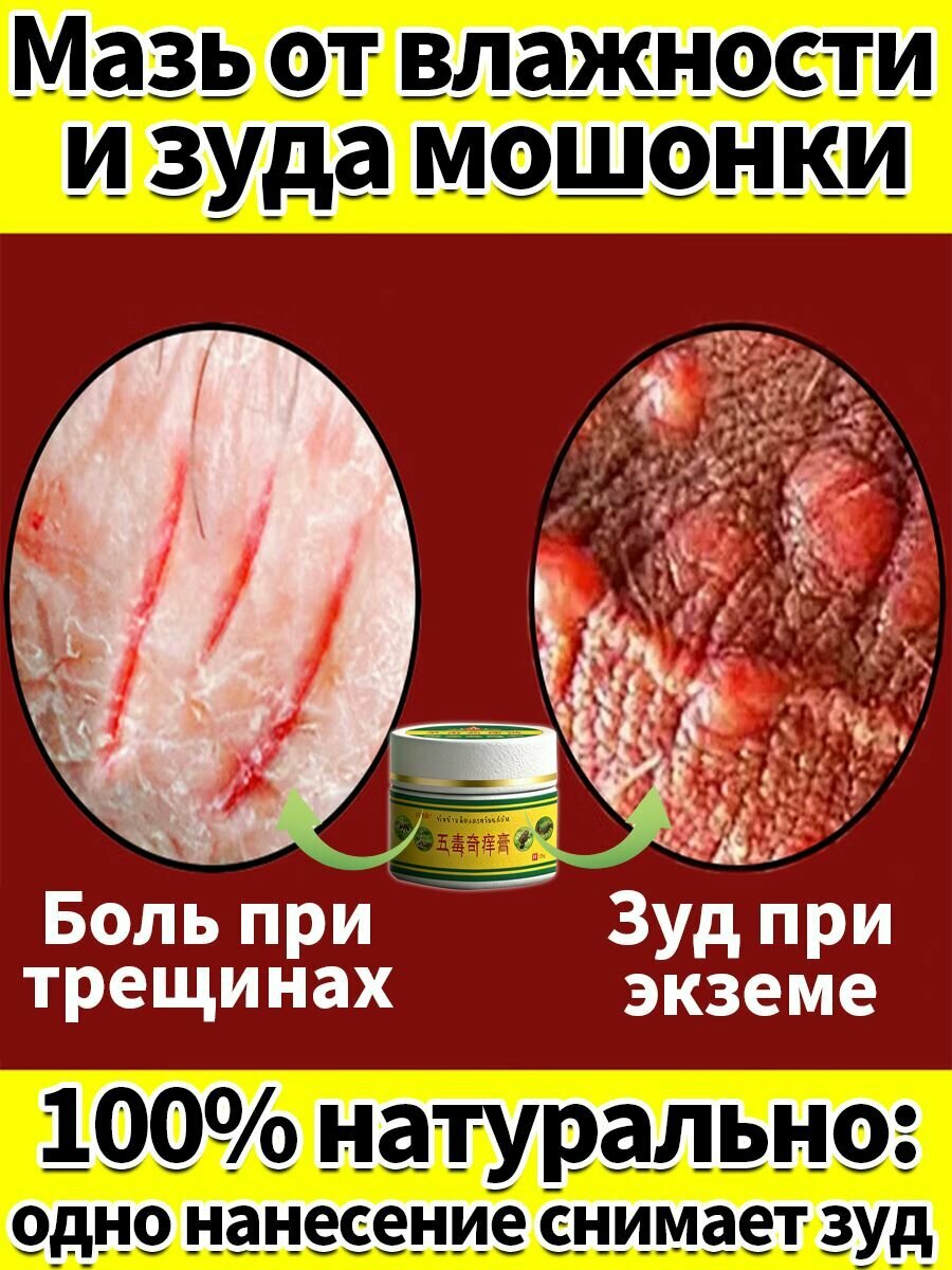 Мазь для лечения экземы мошонки, а также устранения зуда, влажности и жжения. 30 грамм.