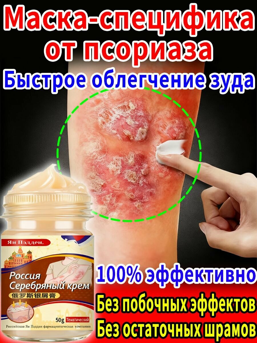 Мазь от псориаза китайская Антипсориаз крем негормональный от дерматита и экземы снимает зуд покраснение и раздражение 50 г
