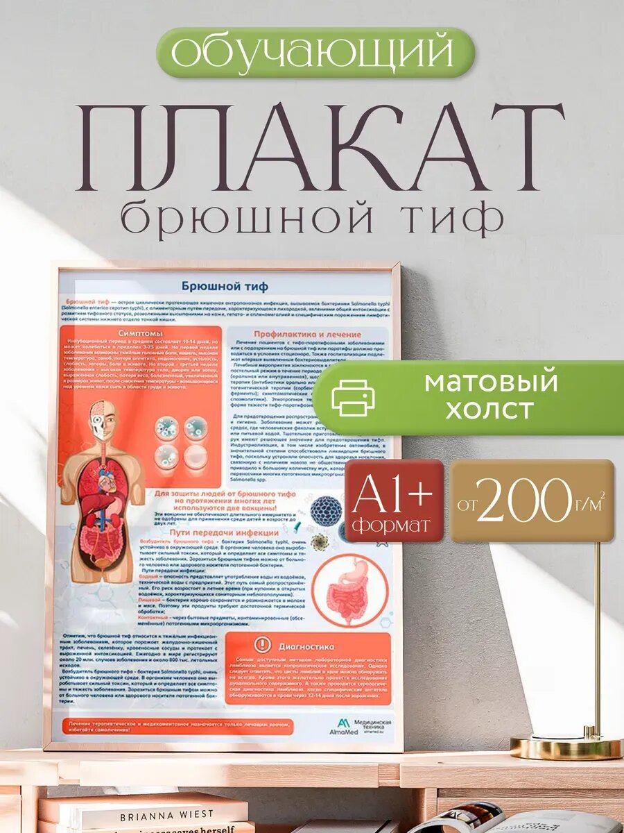 Брюшной тиф медицинский плакат матовый холст от 200 г/кв. м, размер A1+