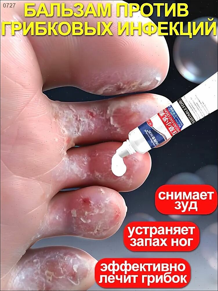 Мазь от грибка ног между пальцев, удаляет грибки, мазь для лечения зуда и язв, неприятного запаха ног, 20 г