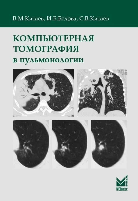 Компьютерная томография в пульмонологии. Китаев
