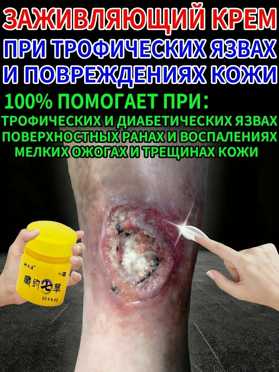 Крем при трофических язвах и сухих трещинах кожи