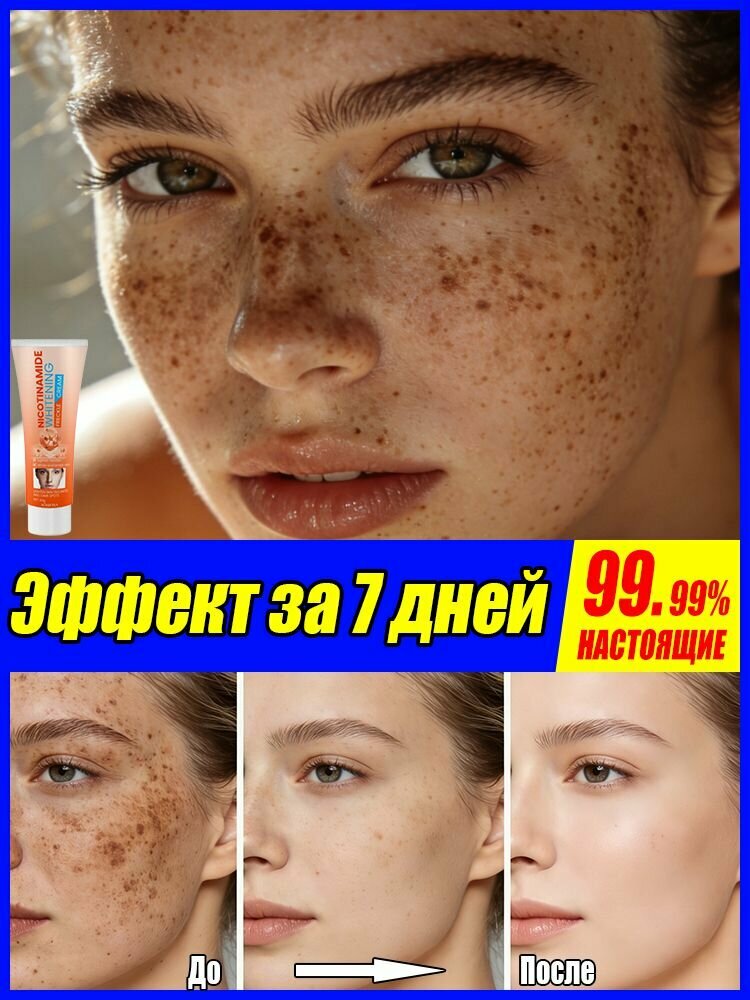 Отбеливающий крем для лица с ниацинамидом и ретинолом, Удаляет пигментные пятна, веснушки, солнечные ожоги, меланодермию, угревую сыпь, морщины.200г