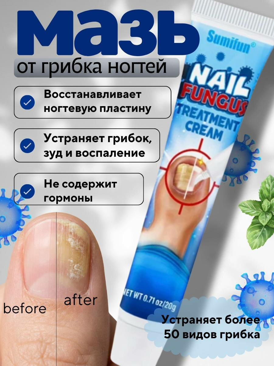 Средство от грибка ногтей на ногах эффективное, мазь от трещин, для пяток и стоп , крем противогрибковая, чудо средство для ухода за ногами , микозе .20мл