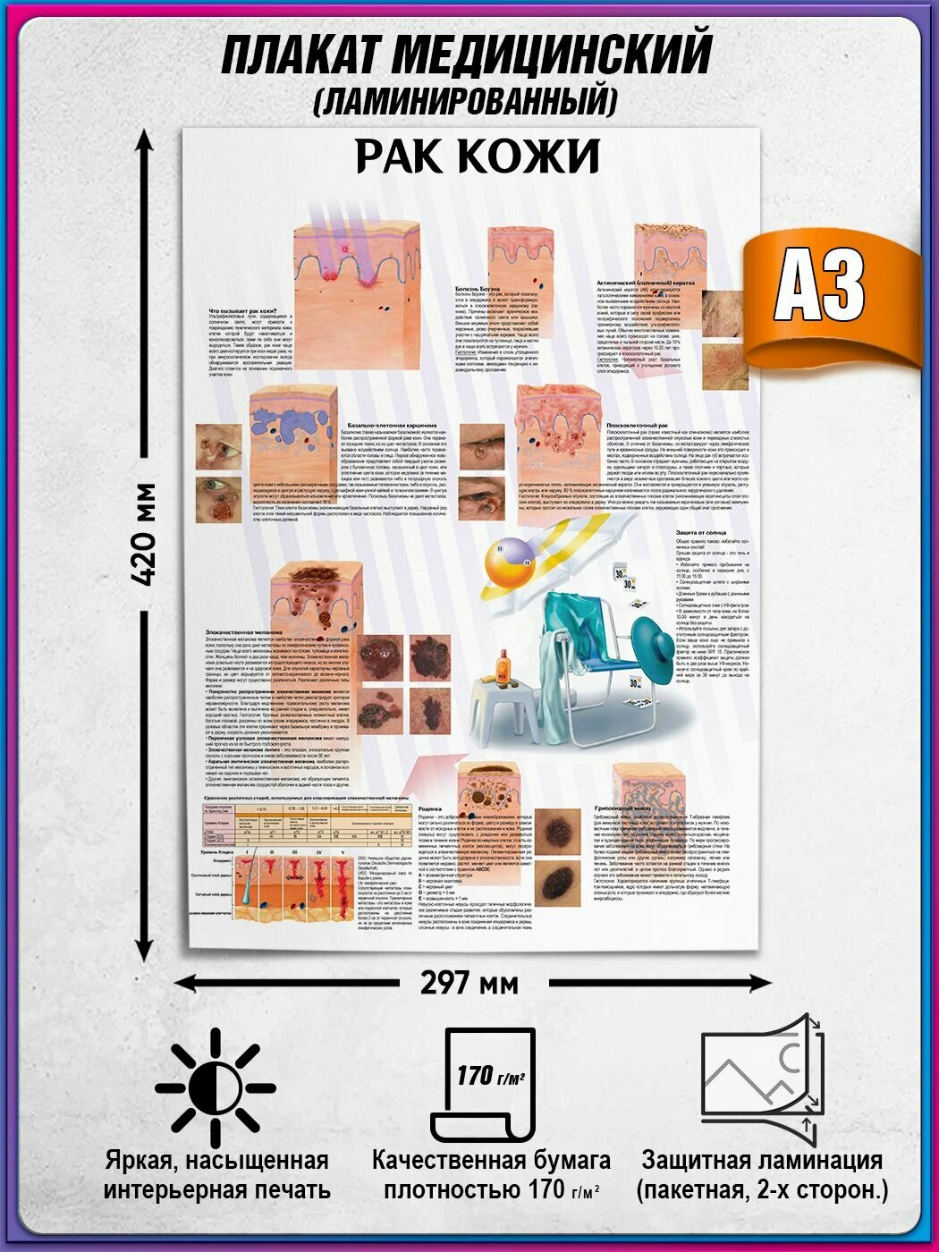 Информационный медицинский плакат "Рак кожи" / ламинированный / Формат А3 (30х42 см.)