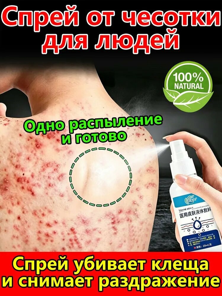 Китайская формула спрей от чесотки, псориаза, экземы и дерматита! Натуральное решение кожных проблем