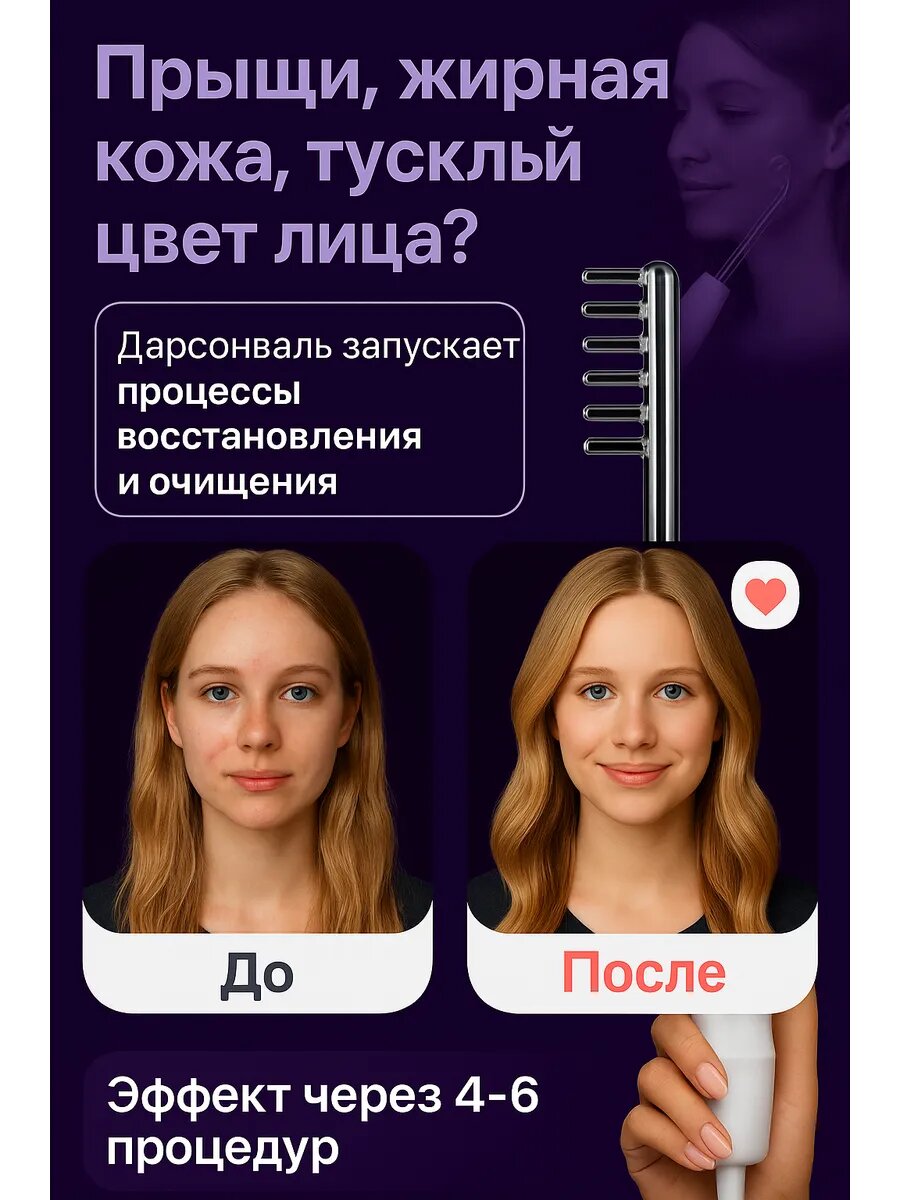 Дарсонваль для волос и лица медицинский — фото 1