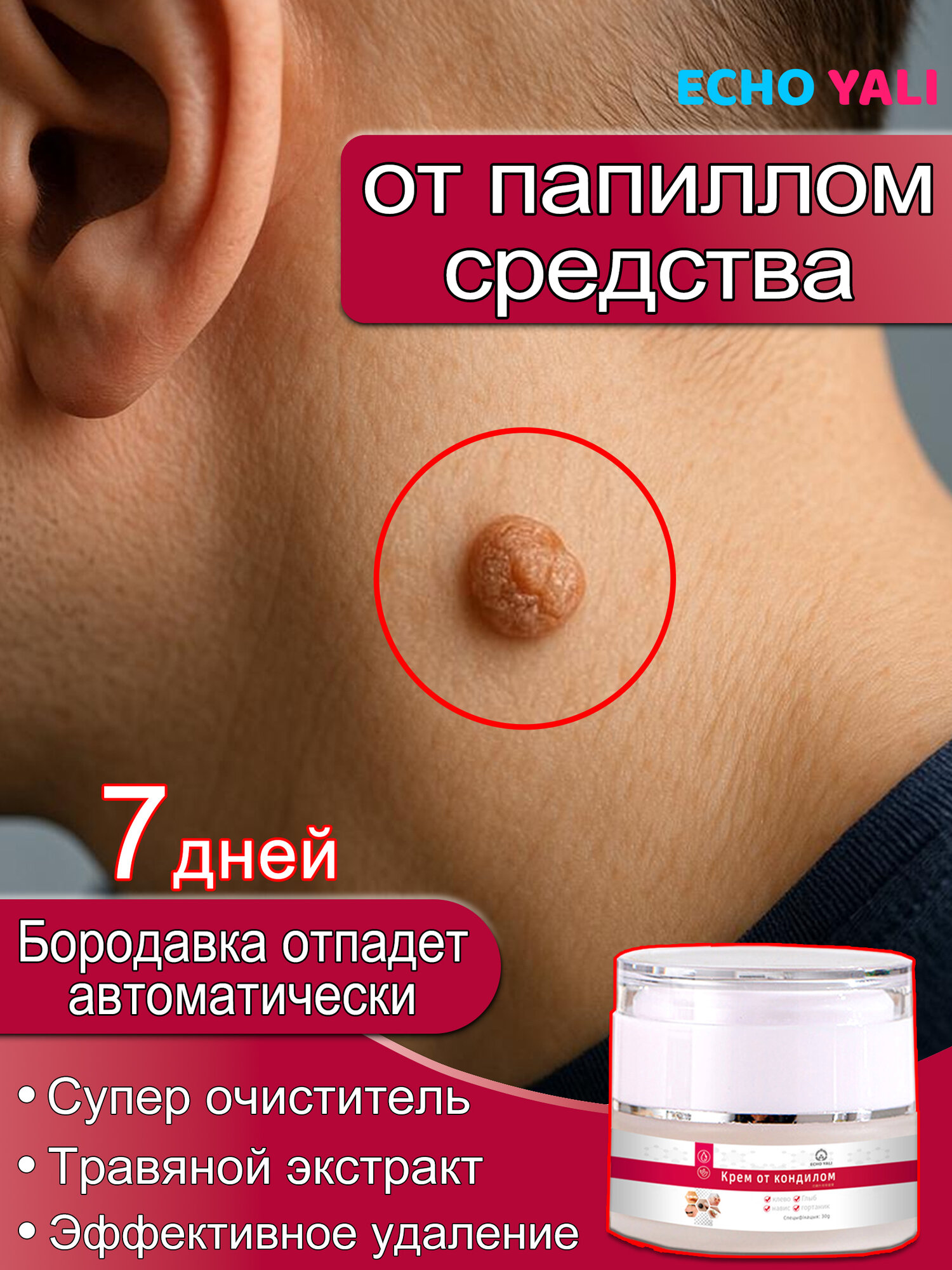 ECHO YALI / Мазь для удаления бородавок, папиллом и новообразований, быстрая и безболезненная, без каких-либо побочных эффектов, растительные ингредиенты, 30 г