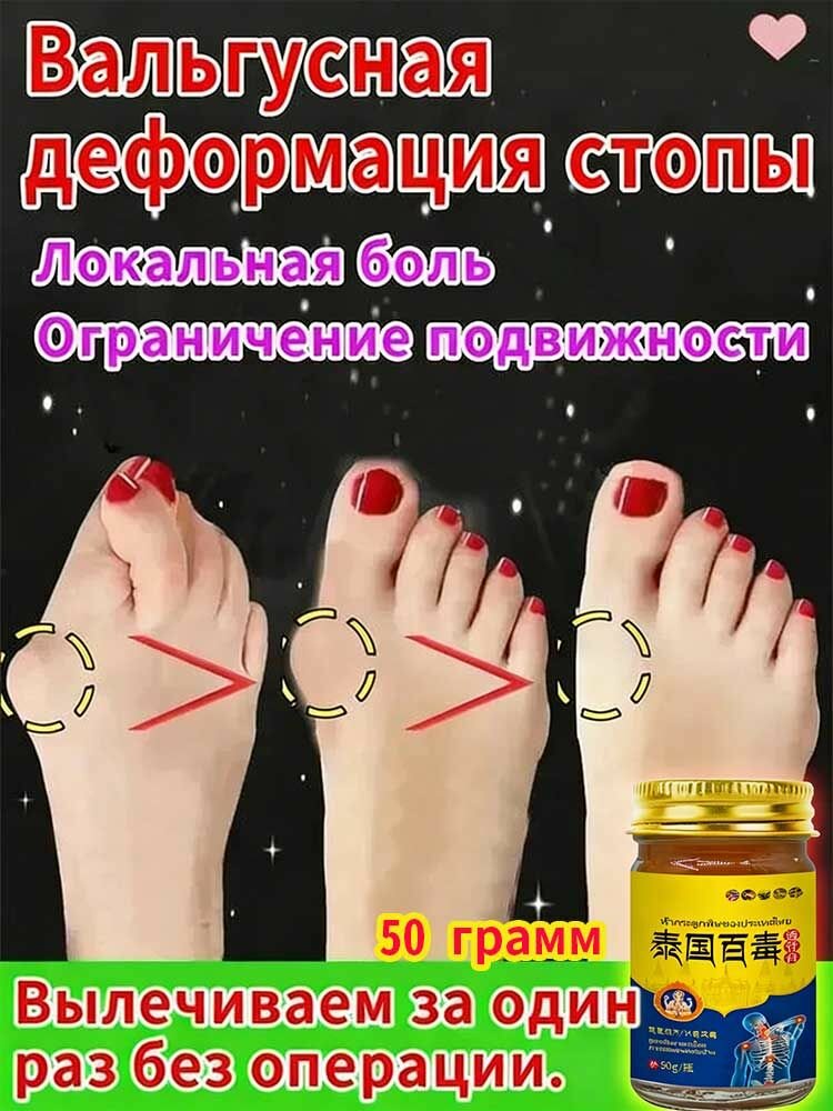 Легендарный тайский крем от косточки на ноге для ног против косточки