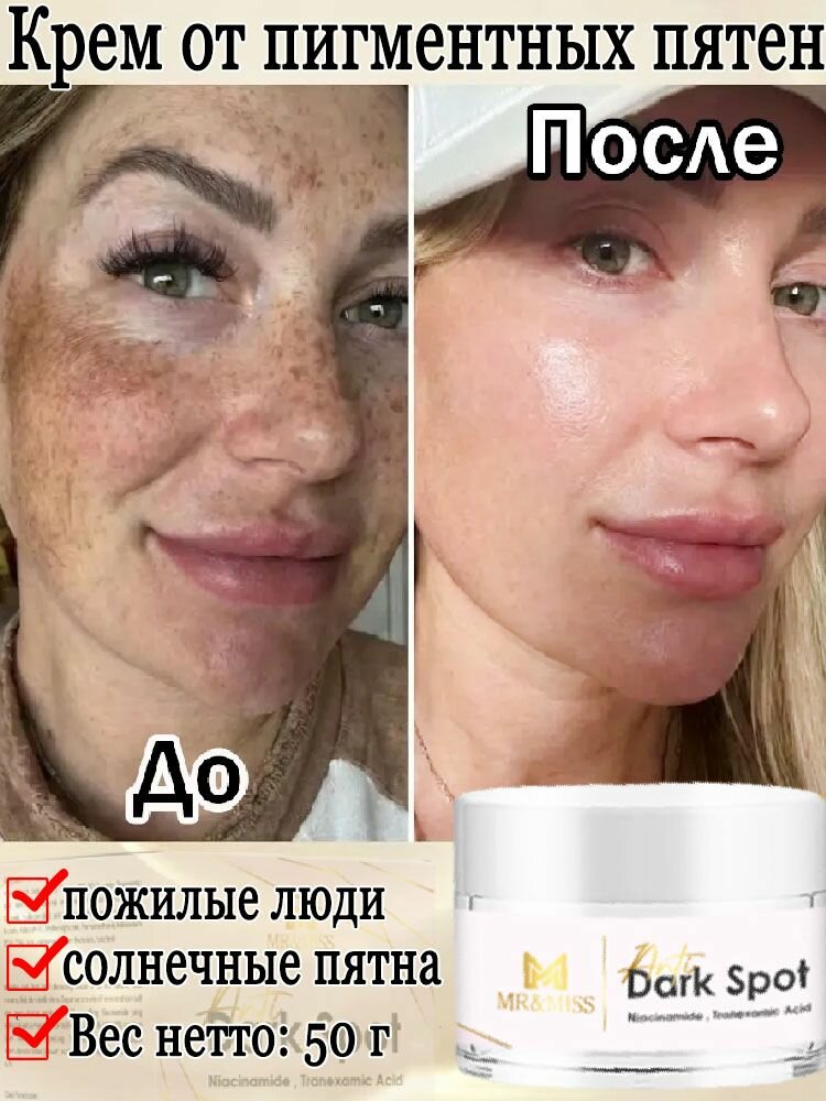 Крем от пигментных пятен на лице, Эффективно удаляет меланин, смягчает хлоазмы и различные пигментные пятна, осветляет тон кожи,50 г